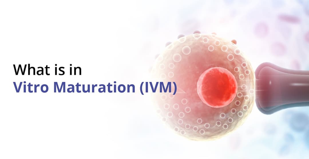 What is In Vitro Maturation (IVM)
