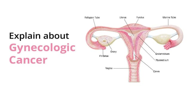 Gynecologic Cancers: Symptoms, Types & Treatment