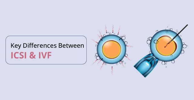 IVF vs ICSI: Difference Between IVF and ICSI Treatments